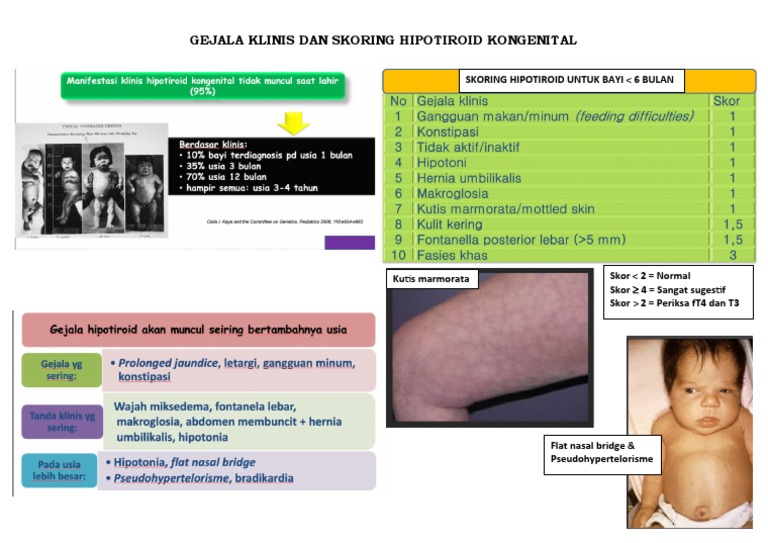 (3) GEJALA KLINIS DAN SKORING HIPOTIROID KONGENITAL | PDF