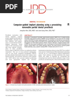 Hotkeys - Exocad | PDF | Cursor (User Interface) | Keyboard Shortcut