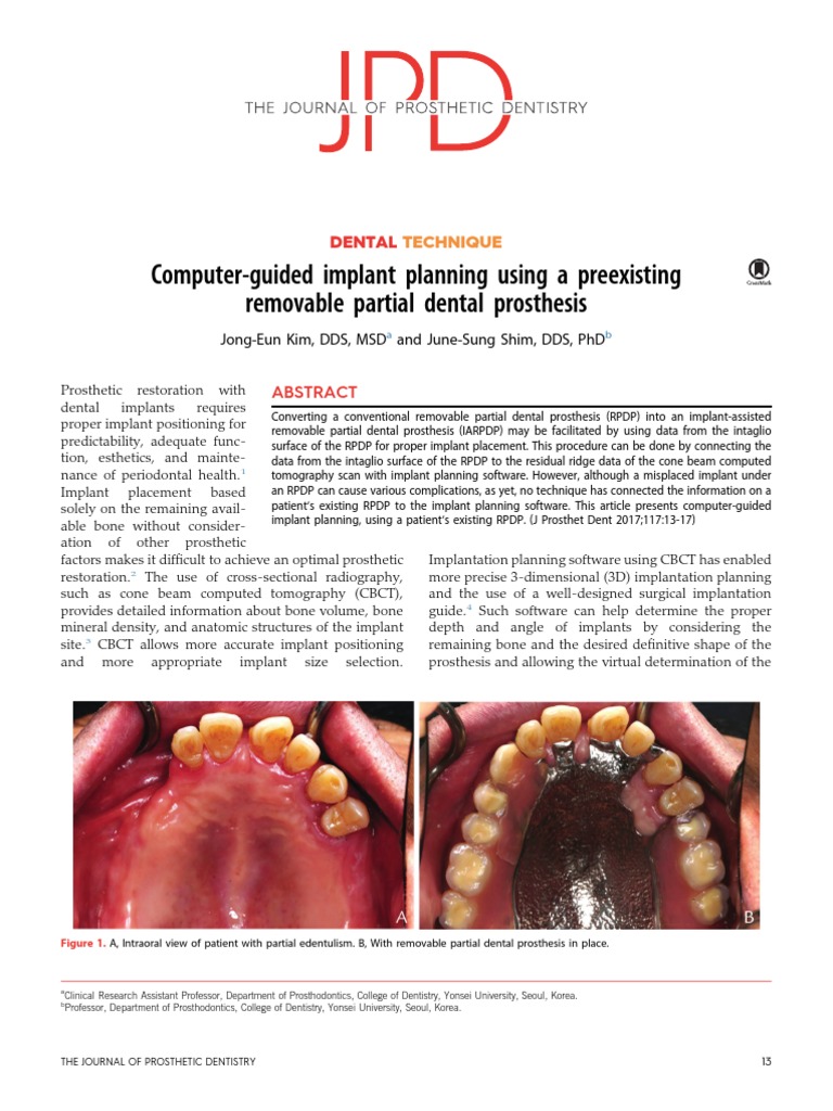 Computer-Guided Implant Planning Using A Preexisting Removable Partial Dental Prosthesis | PDF ...