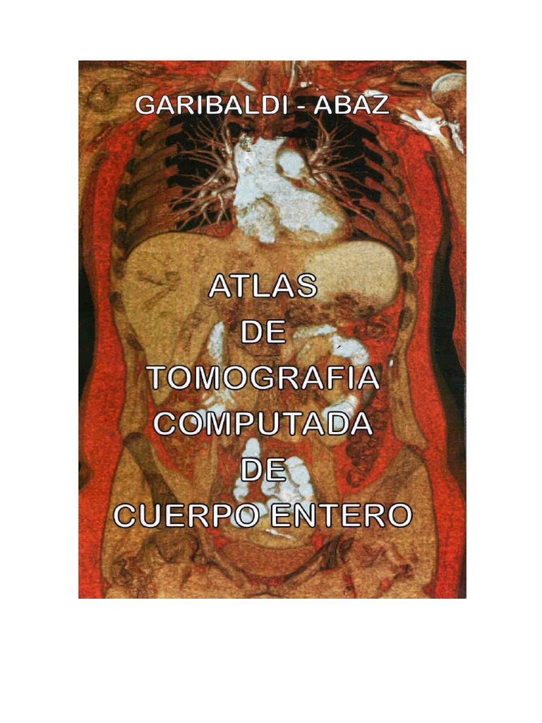 Atlas de Tomografia Computada de Cuerpo Entero | PDF