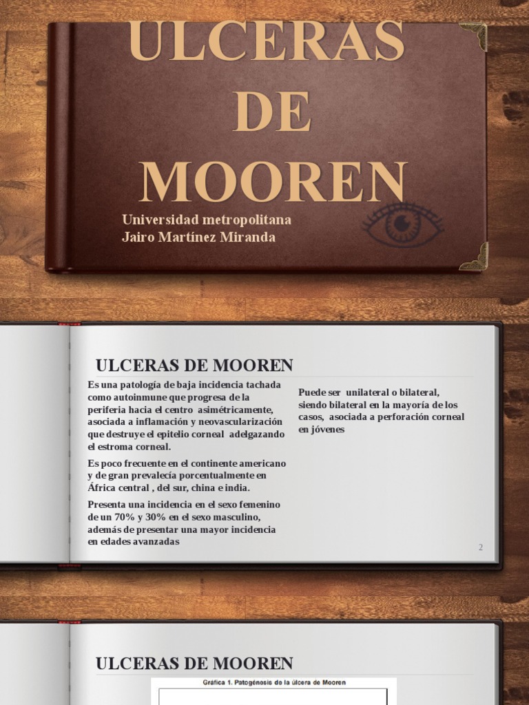 Un análisis completo de las ulceras de Mooren: su patogenia ...