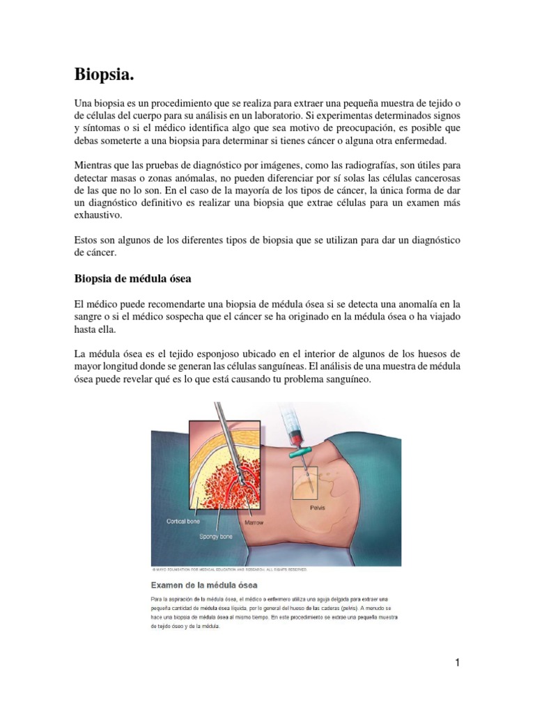 BIOPSIA | PDF | Biopsia | Cáncer