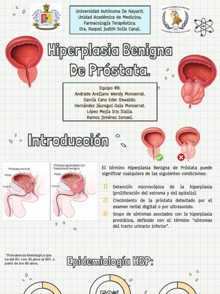 Hiperplasia Prostática: GPC Rápida | PDF | Cancer de prostata ...