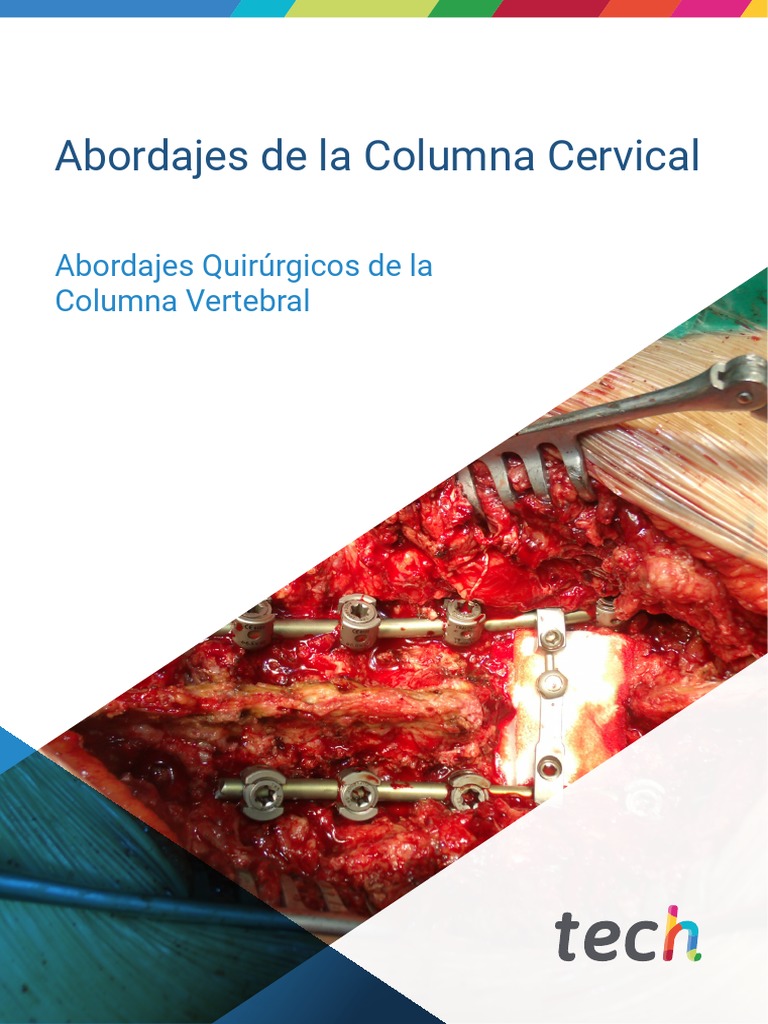Abordajes de La Columna Cervical | PDF | La columna vertebral | Laringe