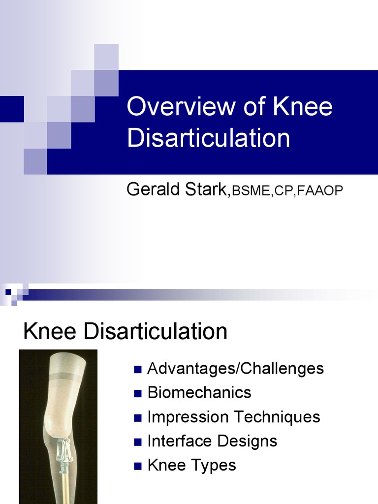 Overview of Knee Dis Articulation | Prosthesis | Knee