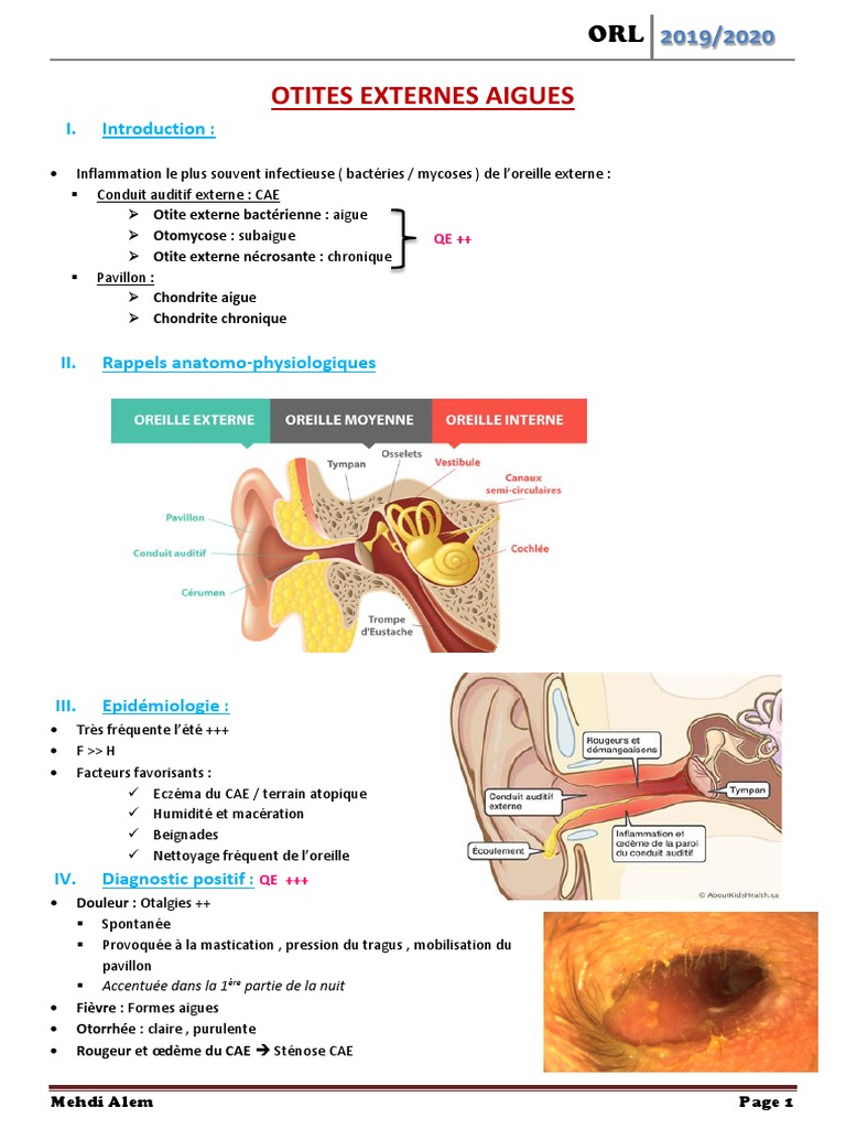 Otites Externes Aigües : Diagnostic et Traitement | PDF | Inflammation ...