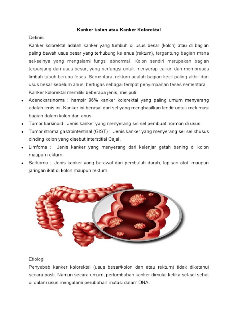 Kanker kolon atau Kanker Kolorektal | PDF