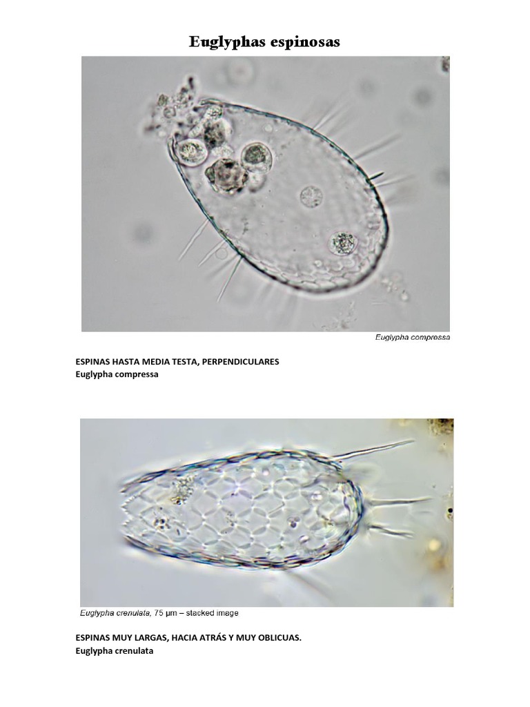 Euglyphas Espinosas PDF | PDF | Cocina, comidas y vino | Salud y bienestar