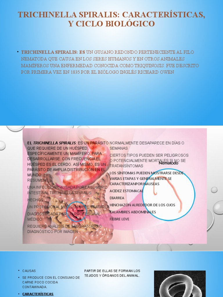 Trichinella Spiralis | PDF | Medicina CLINICA | Ciencias de la Salud