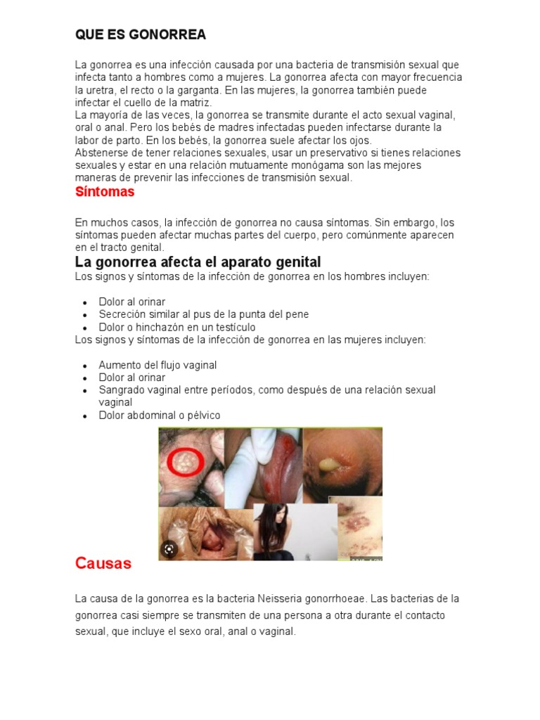 Que Es Gonorrea | PDF | Infección transmitida sexualmente | La sexualidad humana
