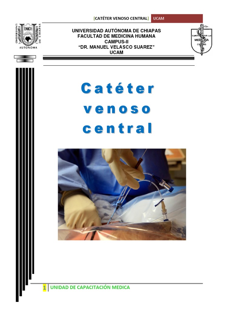Catéter venoso central: guía sobre indicaciones, tipos, técnica de inserción y complicaciones ...
