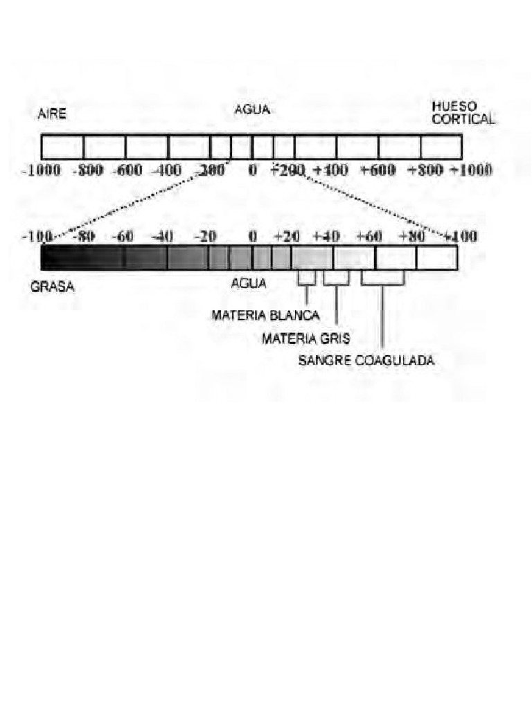 Escala Hounsfield | PDF