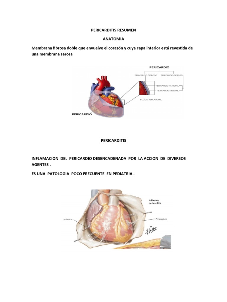 Pericarditis Resumen | PDF
