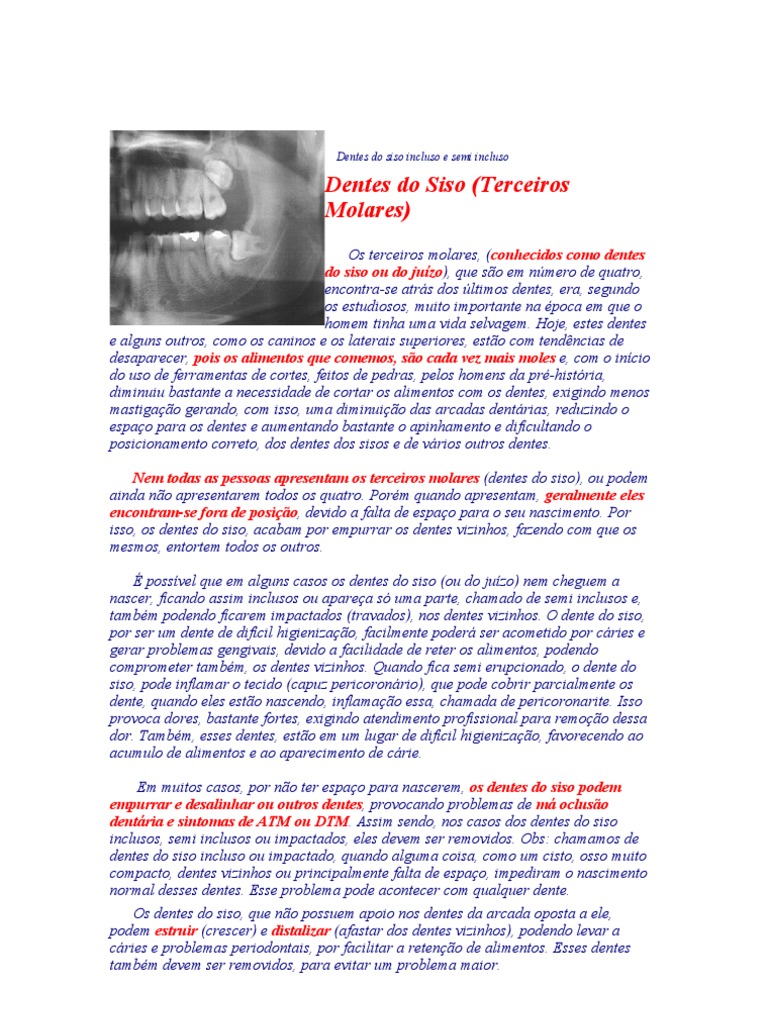 Dentes Do Siso Incluso e Semi Incluso | PDF | Dente | Boca