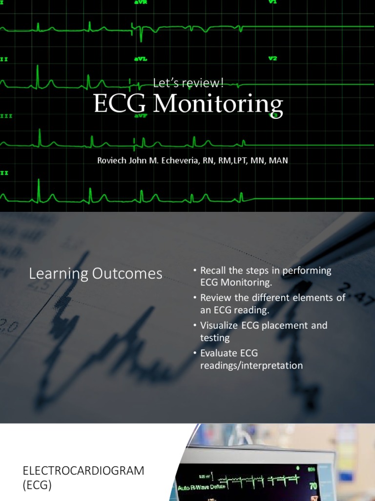 Ecg Monitoring | PDF | Electrocardiography | Medical Imaging