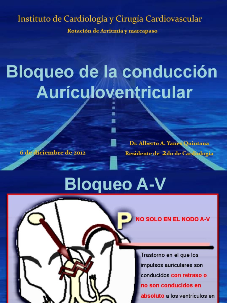 Bloqueos de la conducción auriculoventricular: clasificación y manifestaciones ...