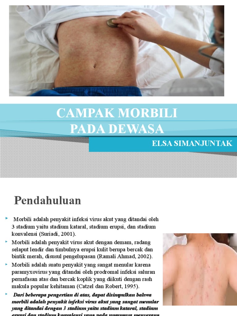 Morbili: Penyakit Infeksi pada Dewasa | PDF