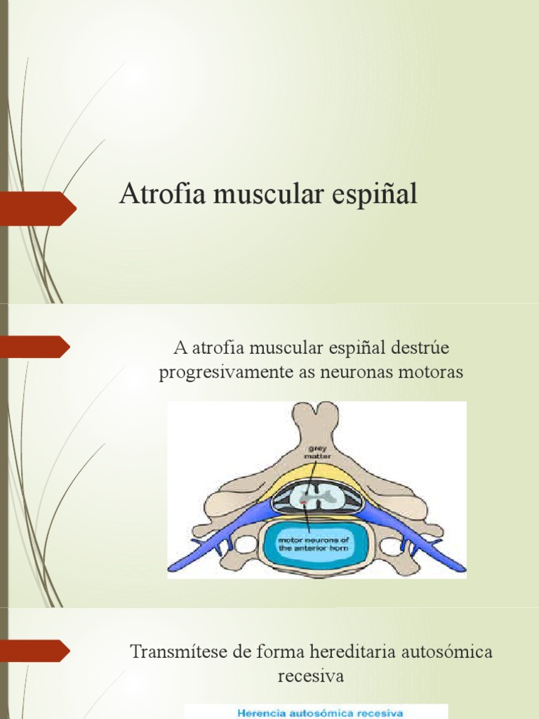 Atrofia Muscular Espinal | PDF