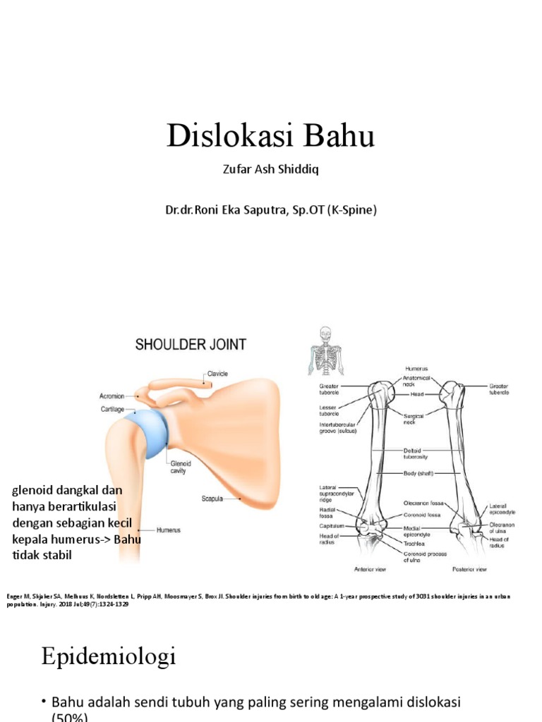 Dislokasi Bahu | PDF