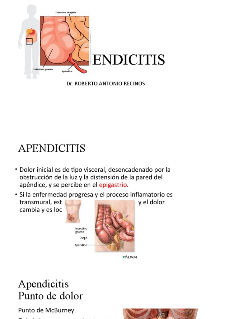 APENDICITIS | PDF | Enfermedades digestivas | Especialidades Medicas