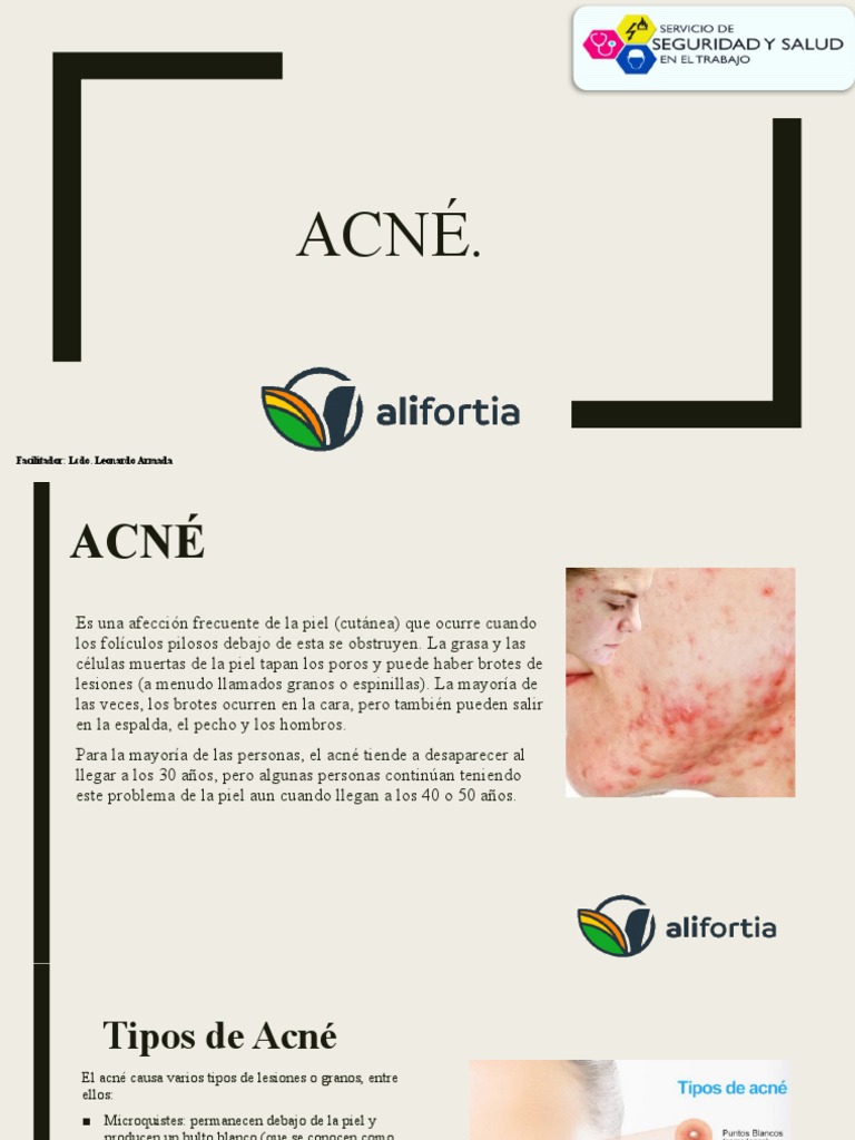 ACNÉ | PDF | Epidemiología | Medicina