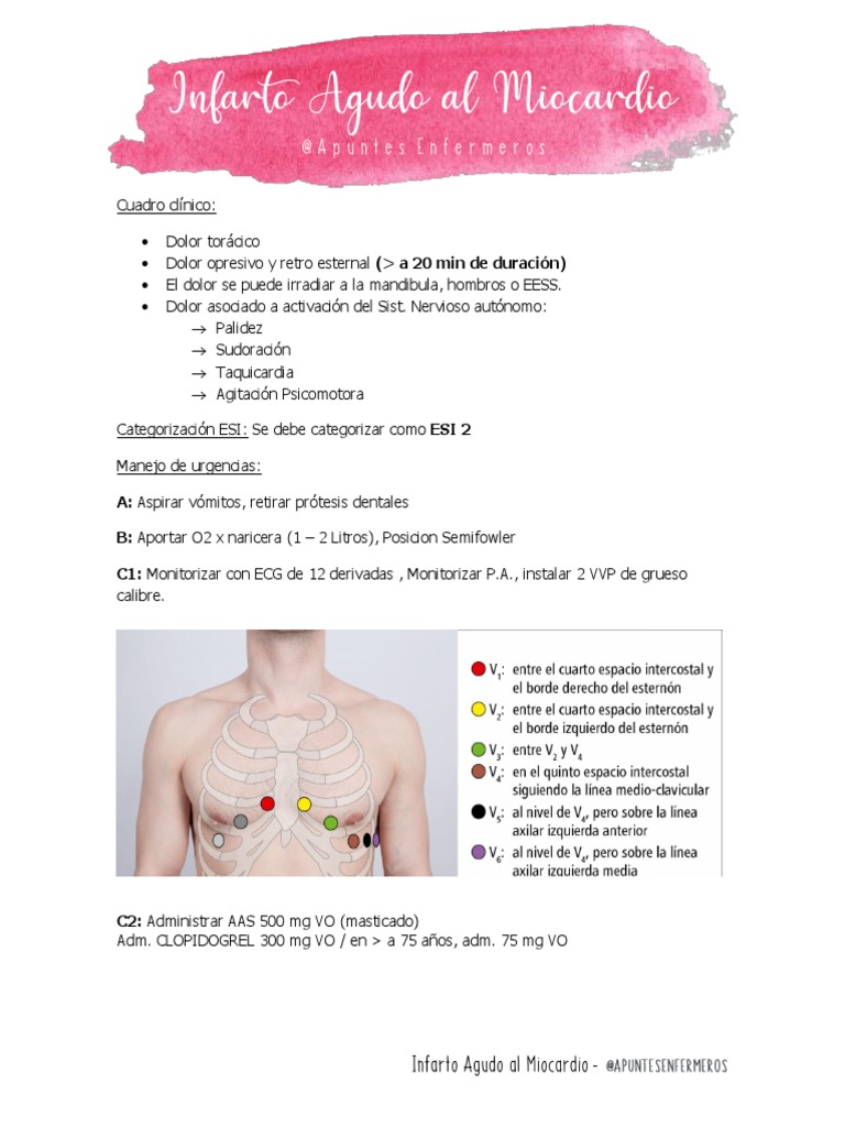 Infarto Agudo Al Miocardio @APUNTESENFERMEROS PDF | PDF | Infarto de ...