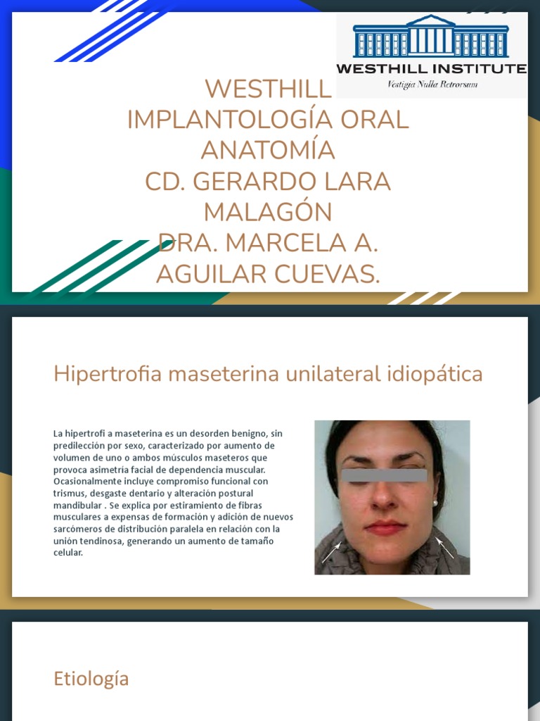 Hipertrofia maseterina unilateral idiopática: reporte de un caso y ...