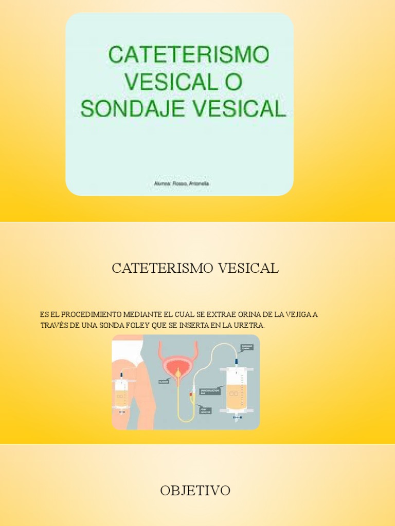 Cateterismo Vesical | PDF | Vejiga urinaria | Anatomía humana
