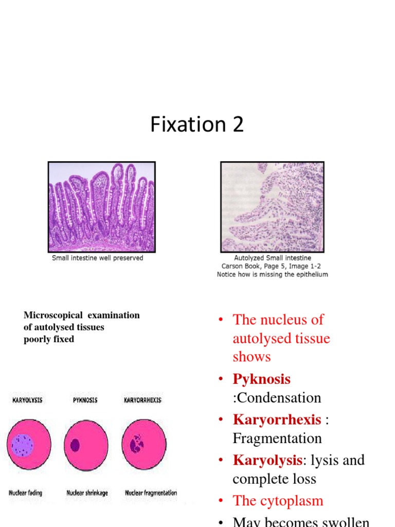 Fixation | PDF