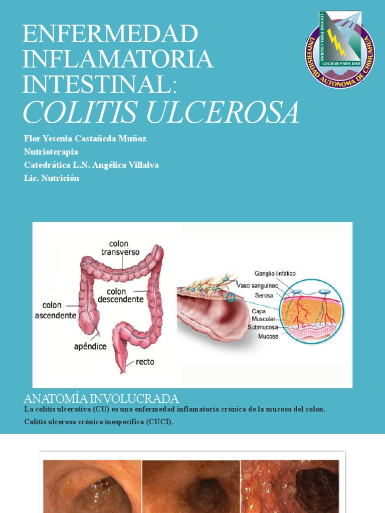 Enfermedad de Cuci | PDF | Gastroenterología | Causas de la muerte