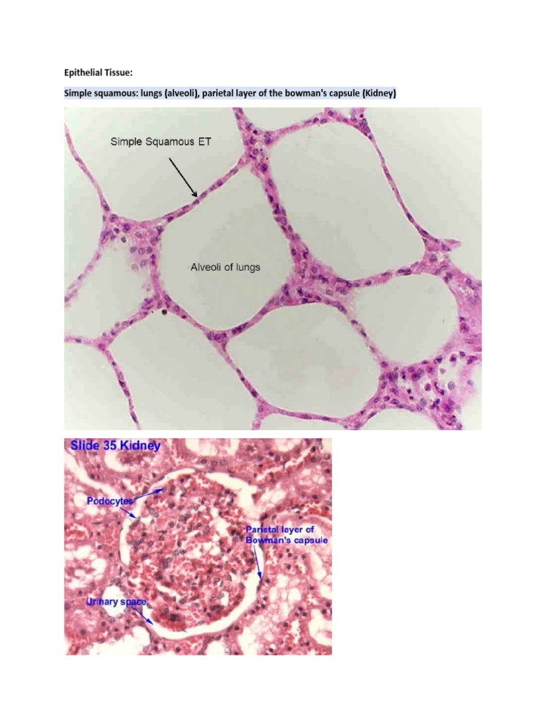 Simple Squamous Epithelium Lung Aveoli