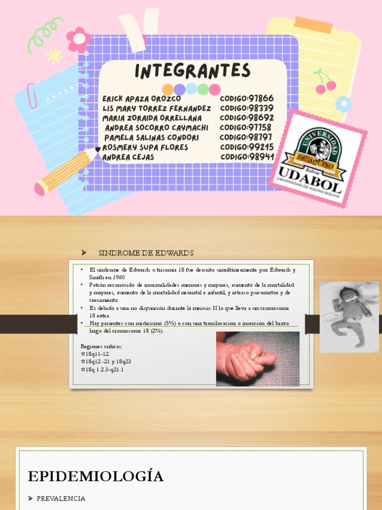 Sindrome de Edwards - PDF | PDF | Especialidades Medicas | Medicina CLINICA