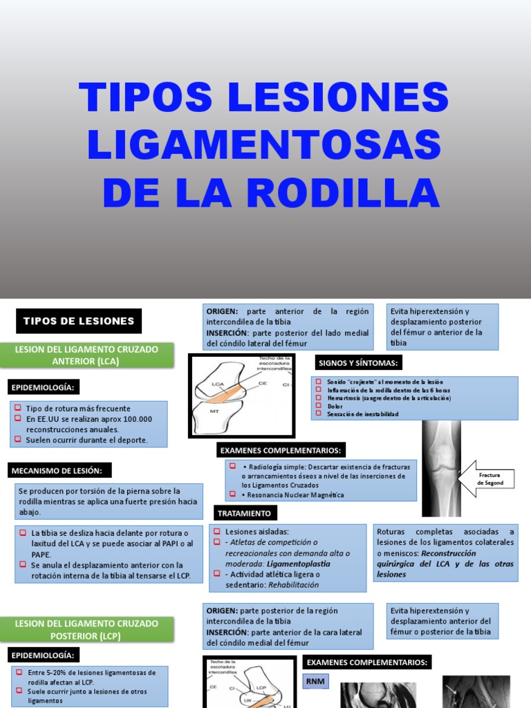 Tipos Lesiones Ligamentosas de Rodilla | PDF | Rodilla | Causas de la ...