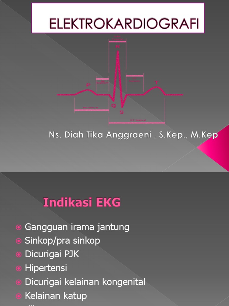 Interpretasi EKG PDF | PDF