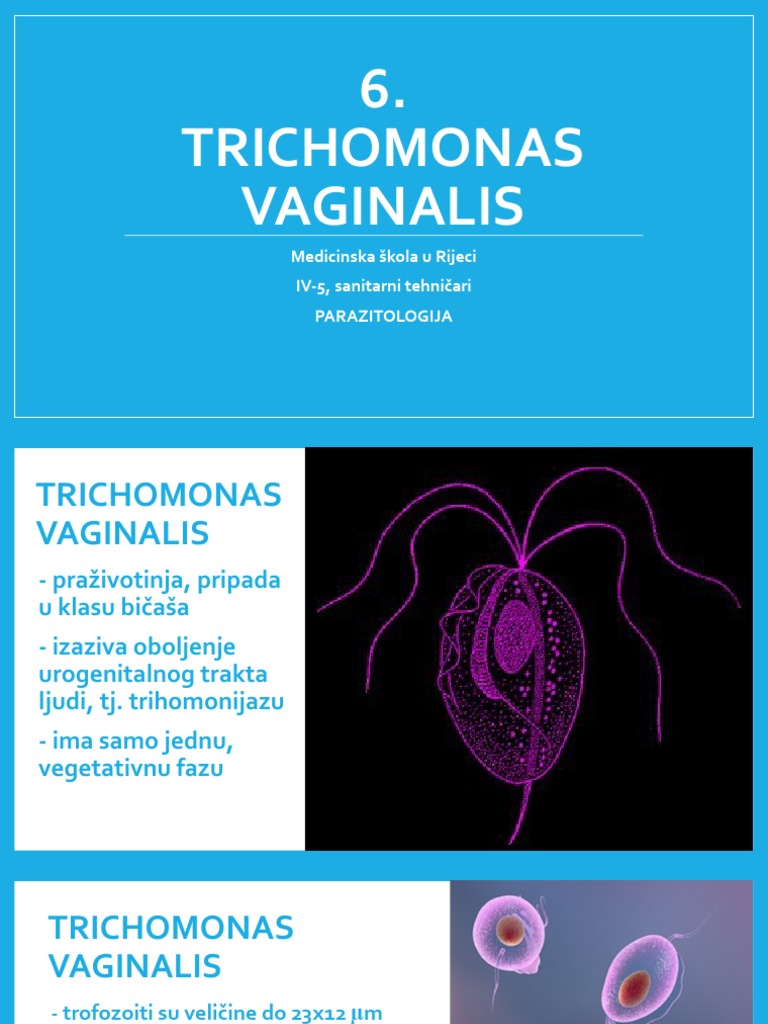 Trichomonas Vaginalis: Medicinska Škola U Rijeci IV-5, Sanitarni ...