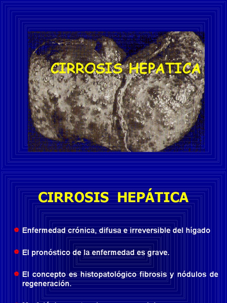 Cirrosis Hepatica | PDF | Cirrosis | Especialidades Medicas