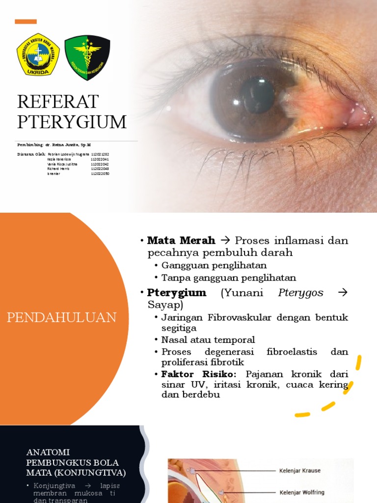 Referat Pterygium | PDF