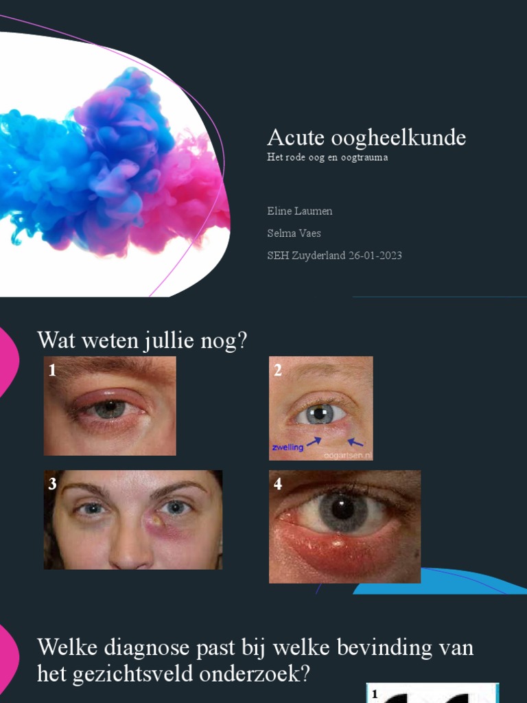 Acute Oogheelkunde | PDF
