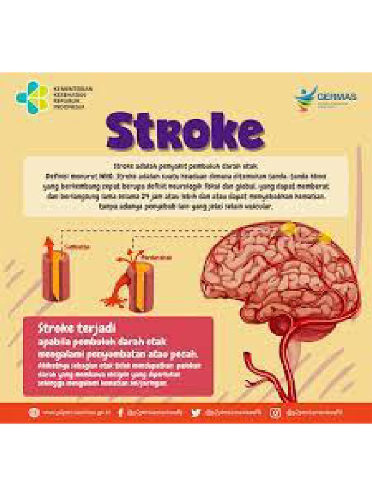 Materi Penyuluhan Stroke | PDF