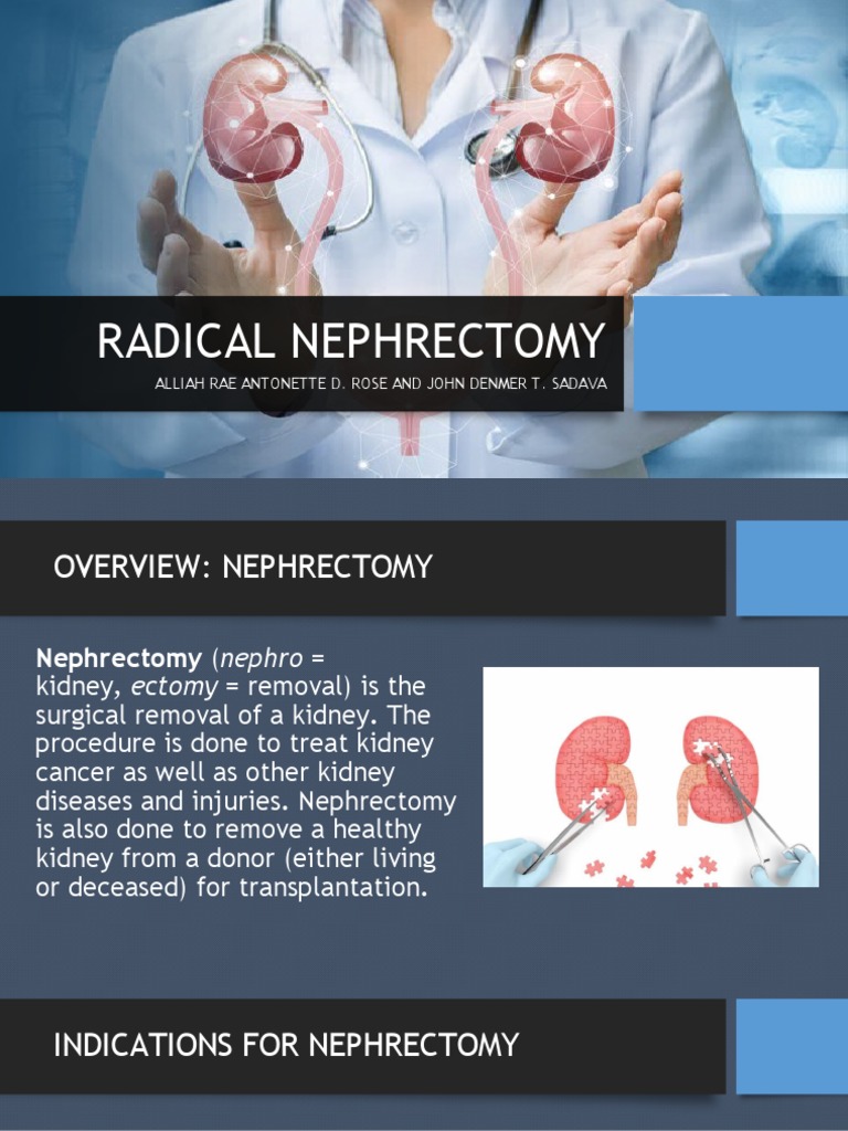Group 2 - Rose & Sadava - Radical Nephrectomy | PDF | Kidney | Medical Specialties