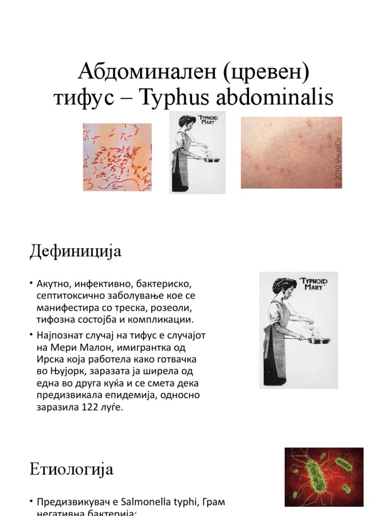 Абдоминален-цревен-тифус-Typhus-abdominalis.pptx | PDF