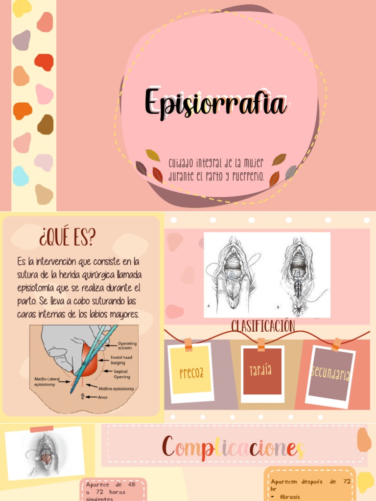 Cuidados de Enfemería Episiorrafia PDF | PDF