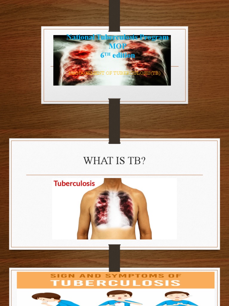 National Tuberculosis Program | PDF