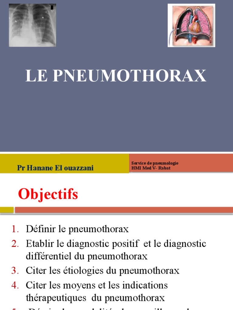 Pneumothorax : Diagnostic et Traitement | PDF | Poumon | Système ...