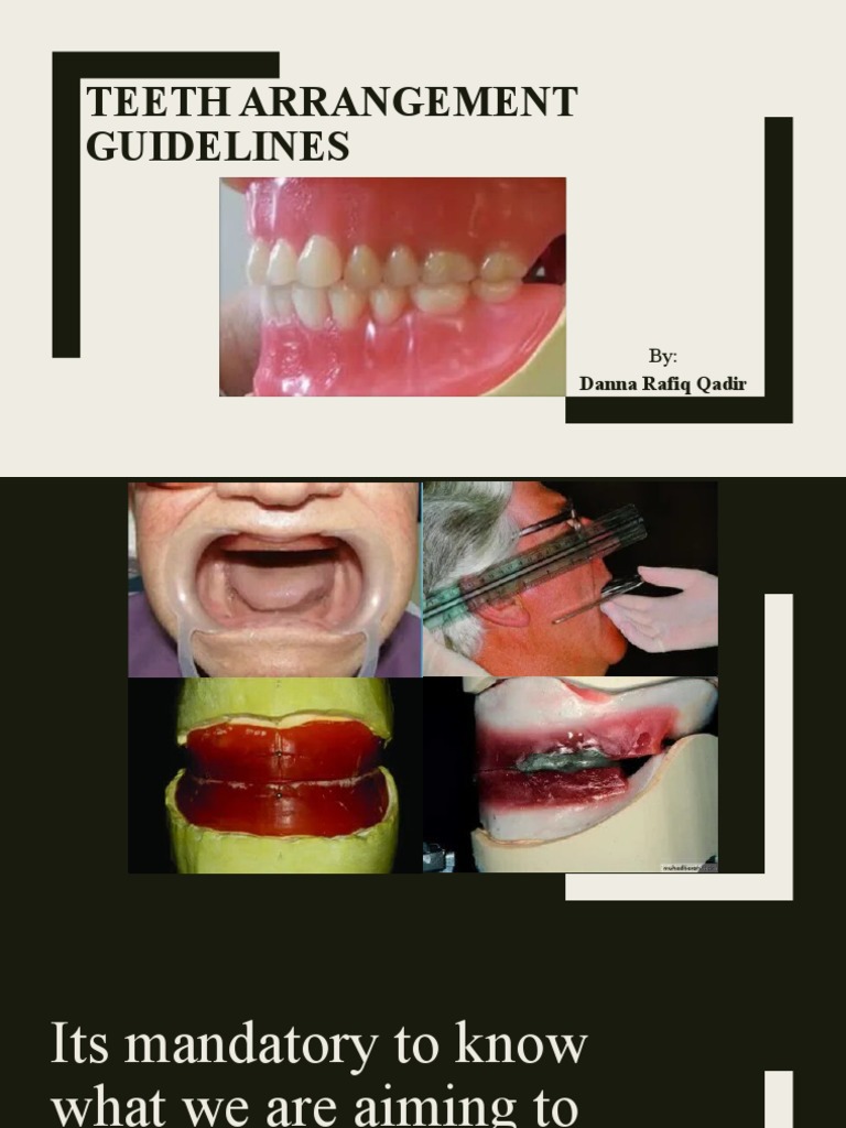 Teeth Arrangement Guidelines | PDF | Tooth | Mouth