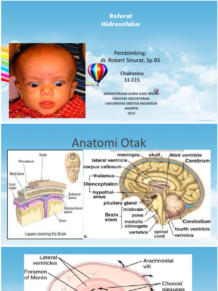 Dokumen - Tips - Hidrosefalus PPTPPTX 566324a19c702 | PDF