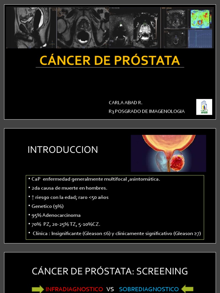 Cáncer de Próstata: Diagnóstico y Tratamiento | PDF | Antígeno ...