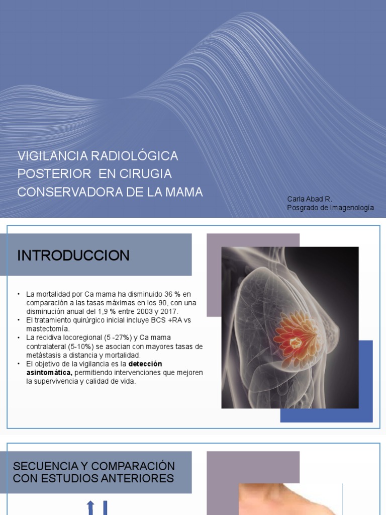 cirugia conservadora de la mama carla abad.pptx | PDF | Mamografía | Pecho