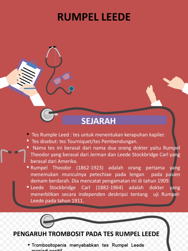 Pemeriksaan Rumple Leede | PDF
