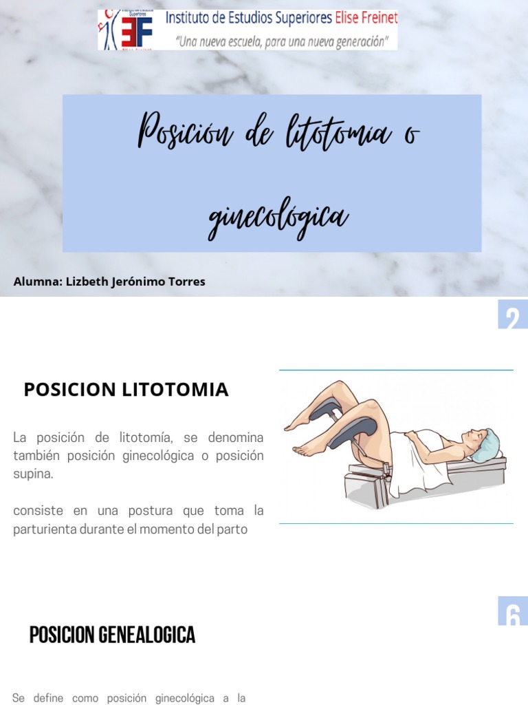 posición litotomia | PDF | Parto | Pelvis posición litotomia | PDF | Parto | Pelvis